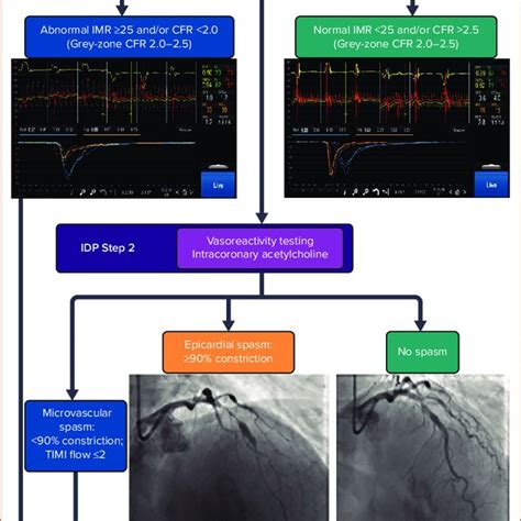 Endo Diagnosis Flowchart At Sophie Denny Blog