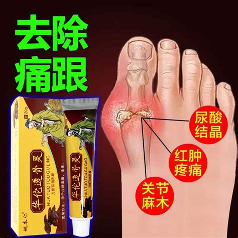 Official Authentic Gout Special Effect Cream Dissolves Crystals To
