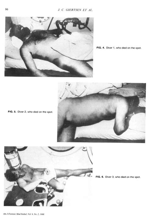 Autopsy Report Of The Byford Dolphin Diving Bell Accident Victims R