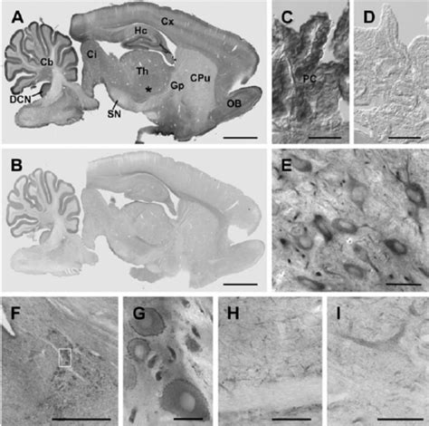 Differential Subcellular Localization Of Sat2 In Select Populations Of