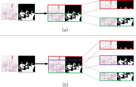 Methods For Image Preprocessing A Non Overlapping Patches B Our