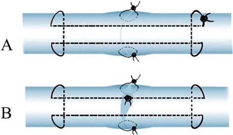 Healing Strength Of Tendon Repair With Or Without Knots Between Two