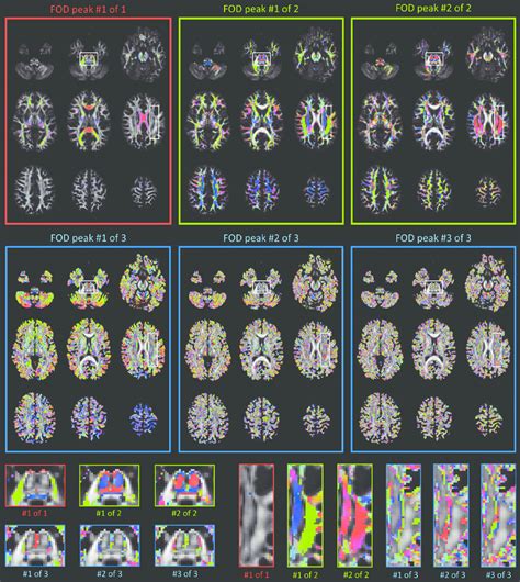 8 direction encoded color dec maps of fi ber orientation distribution