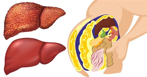 The Amazing Liver Gallbladder Flush Protocol And My Shocking Results