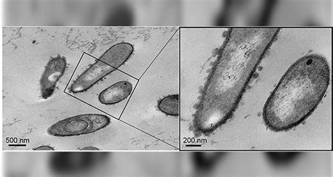 Bacillus Pasteurii Fact 33772
