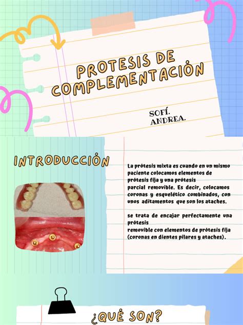 Protesis Complementación Pdf Dentadura Postiza Ramas De Odontología