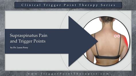 Supraspinatus Pain And Trigger Points Trigger Points Trigger Point