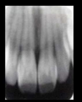 Techniques And Exposure Errors Flashcards Quizlet