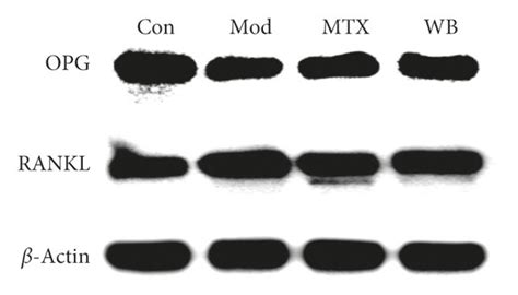 Wb Regulated Opg And Rankl Levels In Cia Mice A Representative Bands