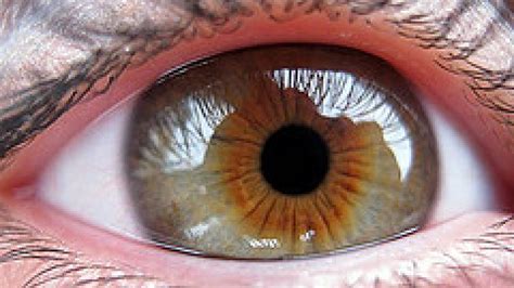 Treating Trichiasis Speaking Of Medicine And Health