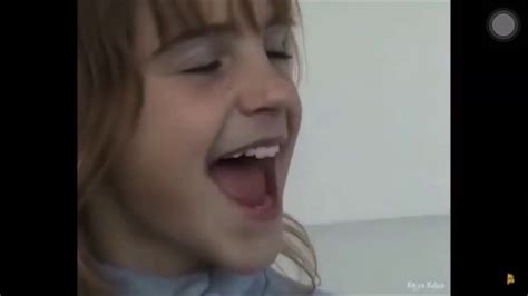 Emma Watsons Teeth Test For Harry Potter And The Philosophers Stone