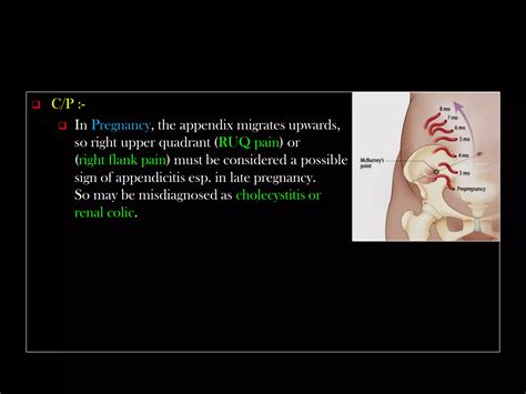 Emergency Ultrasound Course Lecture 04 Acute Appendicitis Part 1 Pdf