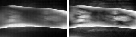 Figure 1 From Vascular Pattern Recognition For Finger Veins Using