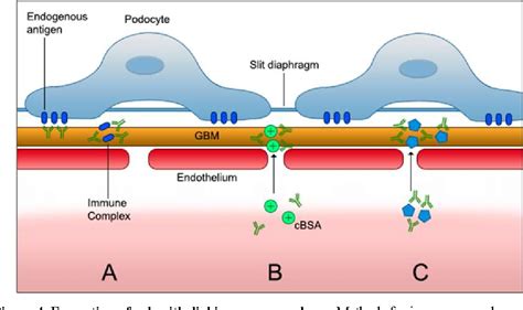 Figure 4 From Distribution Of Circulating And Glomerular Igg Subclasses