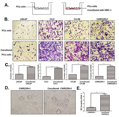 Increased Infiltrating Mast Cells To Pca Enhanced Pca Cell Invasion A Download Scientific