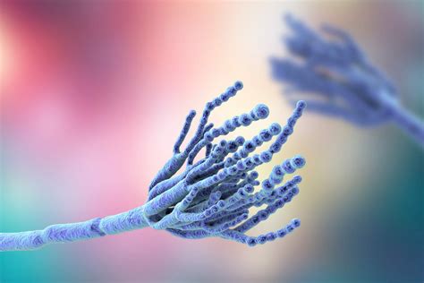 Allergic Fungal Sinusitis Symptoms Diagnosis And Treatment Sinushealth