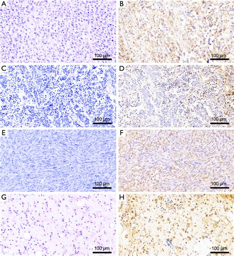 Hande And Ihc Staining Of Geft In Ctas ×200 Hande A C E G And Ihc Download Scientific Diagram