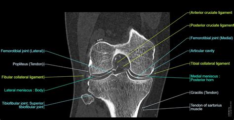Anatomy Of The Knee Ct Arthrography E Anatomy