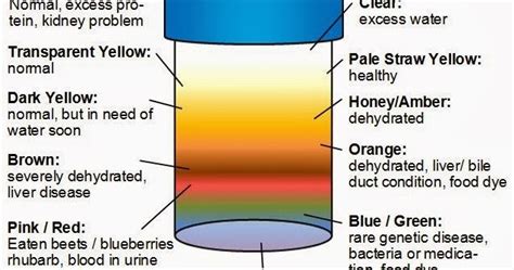 What The Urine Color States About Your Health Wise Thinks