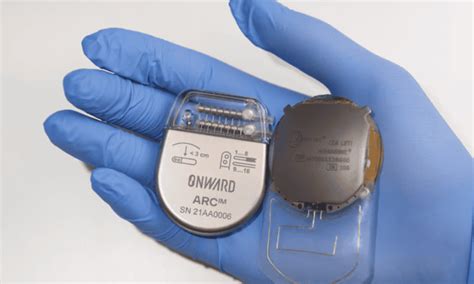 Onward Ho First Patient Implanted With Bci Equipped Neurostimulator To Restore Arm Function