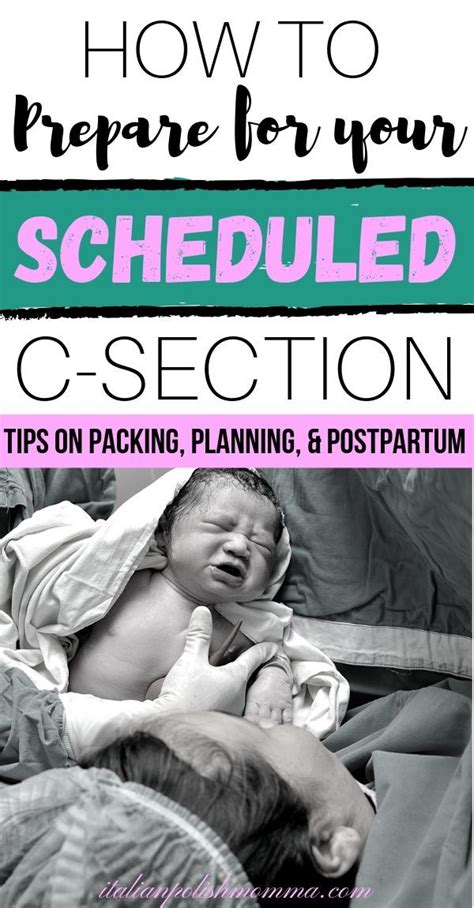 14 Things To Expect With A Scheduled C Section Artofit