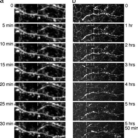 Two Photon Time Lapse Imaging Of Dendritic Spines And Axonal