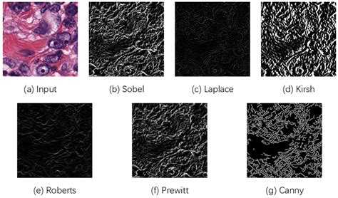 Edge Guided Cell Segmentation On Small Datasets Using An Attention Enhanced U Net Architecture
