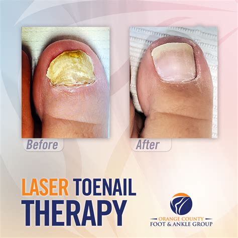 Orange County Foot And Ankle Group