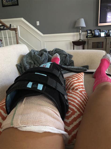 Day One Post Op I Had An Acl Repair With A Patella Graft Along With
