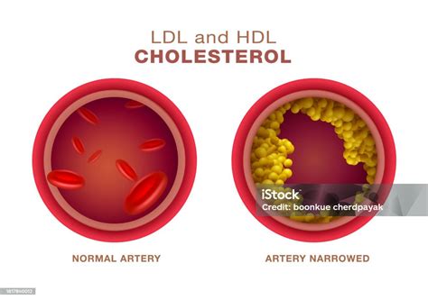 Ldl And Hdl Cholesterol Stock Illustration Download Image Now