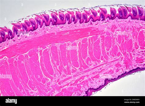 Filiform Papillae Histology Filiform Papillae Histology