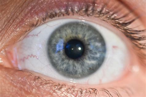 Irisdiagnose Und Augendiagnose Natur Gedankennatur Gedanken