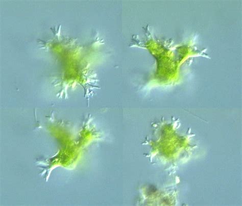 Protist Images Tetraedron Limneticum