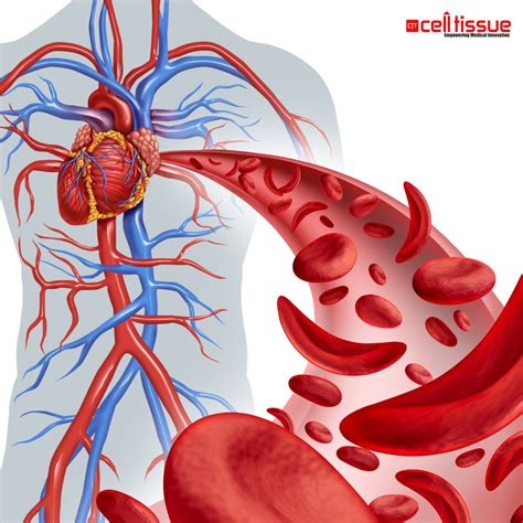 Thalassemia Screening Blood Test Package Cytolife