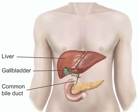 Épinglé Sur Laparoscopic Gallbladder Stone Removal Surgery