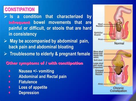 What Causes A Prolapsed Bowel Rectal Prolapse Causes Symptoms And