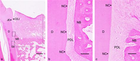 Representative Photomicrographs Of A Two Wall Intrabony Defect Treated