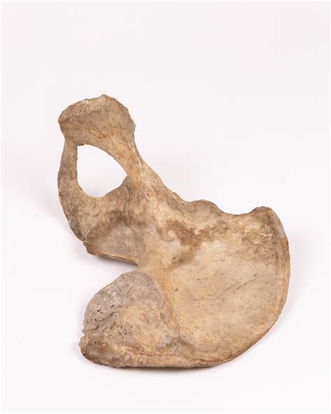 Antique Human Bone Pelvis Natural History Specimen On The Square