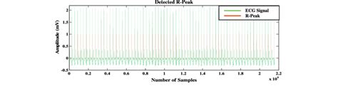 Detected R Peaks Of Ecg Signal Download Scientific Diagram