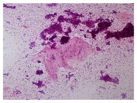 Bipolar And Bare Cells Cohesive Cell Groups Download Scientific Diagram