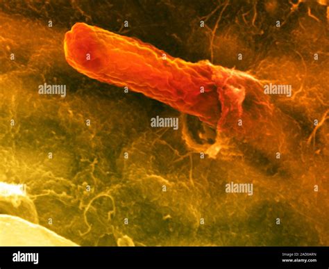 Soya Bean Root Nodule Coloured Scanning Electron Micrograph Sem Of A Root Nodule Upper