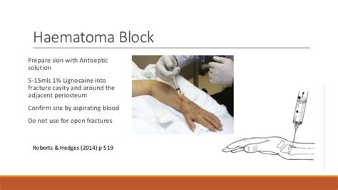Colles Fracture Reduction