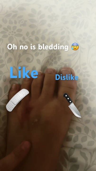 That Is Bledding😰 Youtube