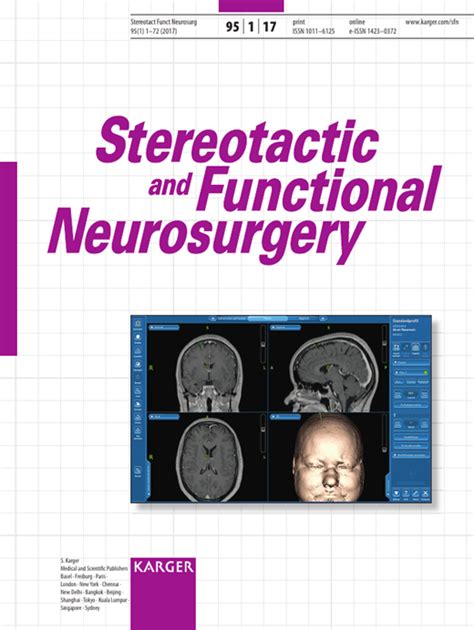 Use Of Spinal Cord Diffusion Tensor Imaging To Quantify Neural Ablation