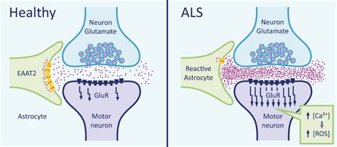 Als Amyotrophic Lateral Sclerosis Graphs