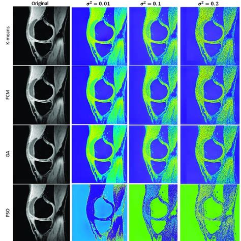 Structure Of Cifar10 Quick Model Download Scientific Diagram