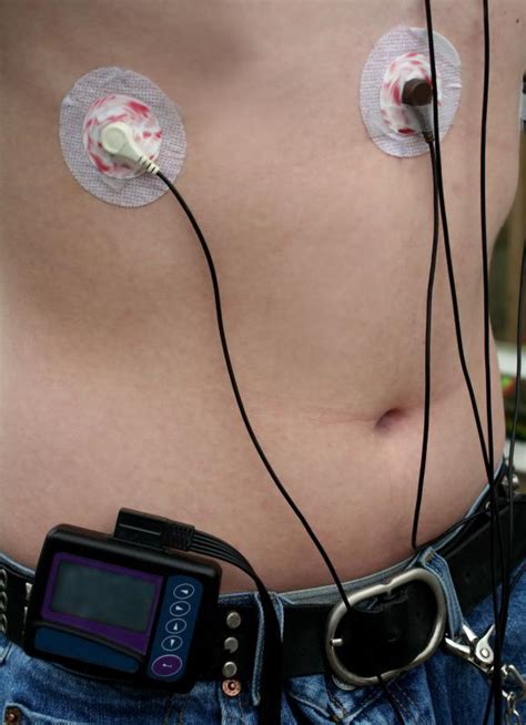 What Is Telemetry Monitoring With Pictures