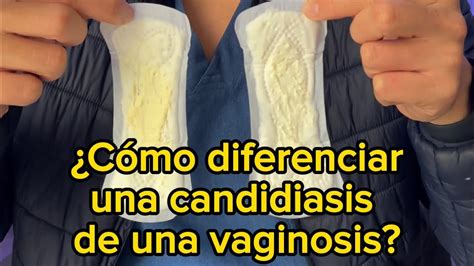 Diferencias Entre Candidiasis Y Vaginosis Dr William Guerrero Youtube