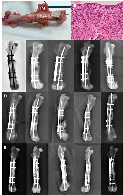 A Three Dimensional Printed Polycaprolactone Scaffold Combined With Co Ijn