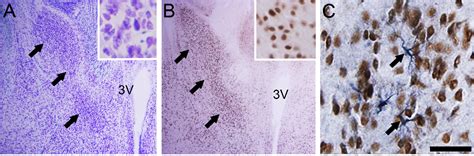 Figure 1 From Sex Differences In Neun And Androgen Receptor Positive Cells In The Bed Nucleus